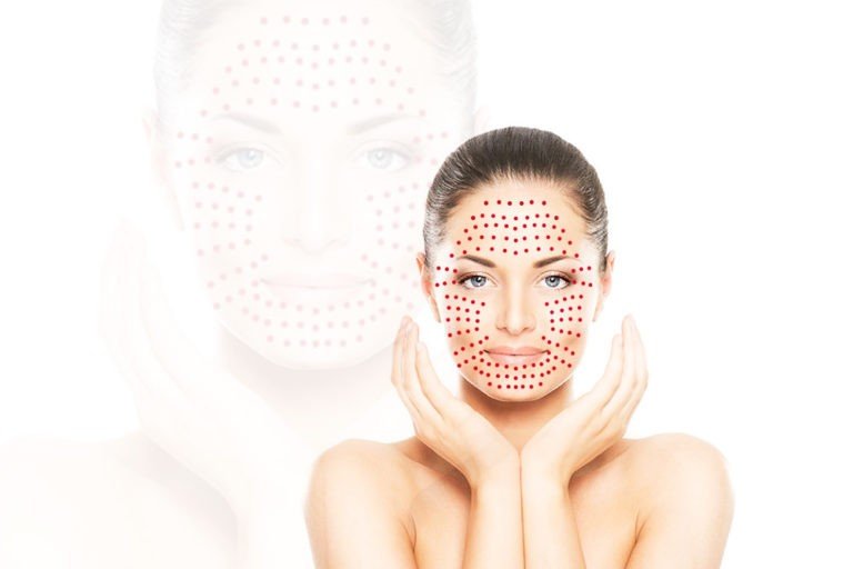 Vampire Facial Benefits | PRP Facial | PRP Anti-Aging