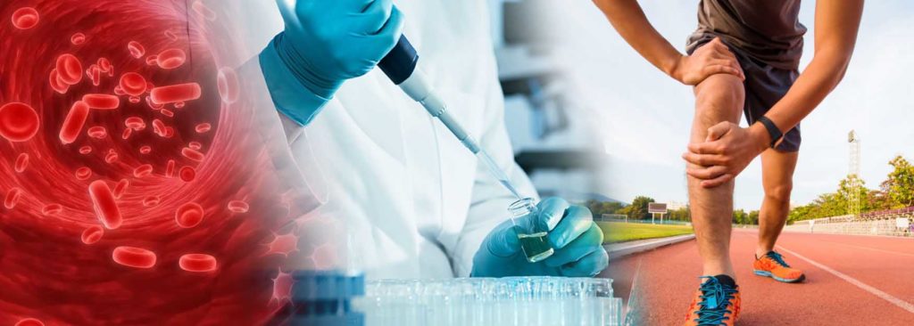 PRP Shoulder Injection | PRP for Shoulder Labral Tear