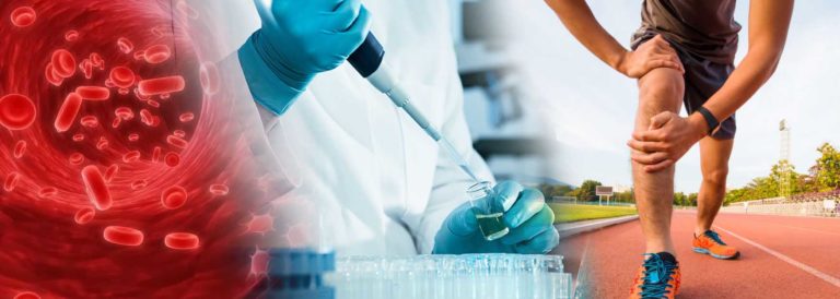 PRP Knee Injection Treatment| Prp Injection Knee Meniscus