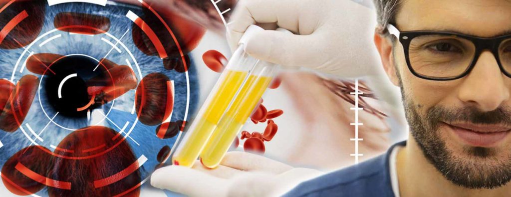 PRP Ophthalmology | Eye Therapy | PRP Injection MD