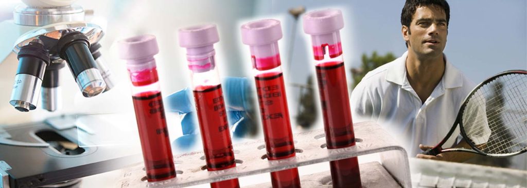 PRP Injection Before & After | Platelet Rich Plasma Reviews