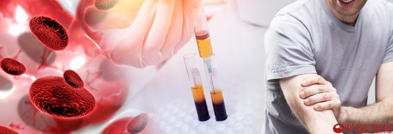 Biceps Tendonitis Treatment | Tendon Repair | PRP Injection